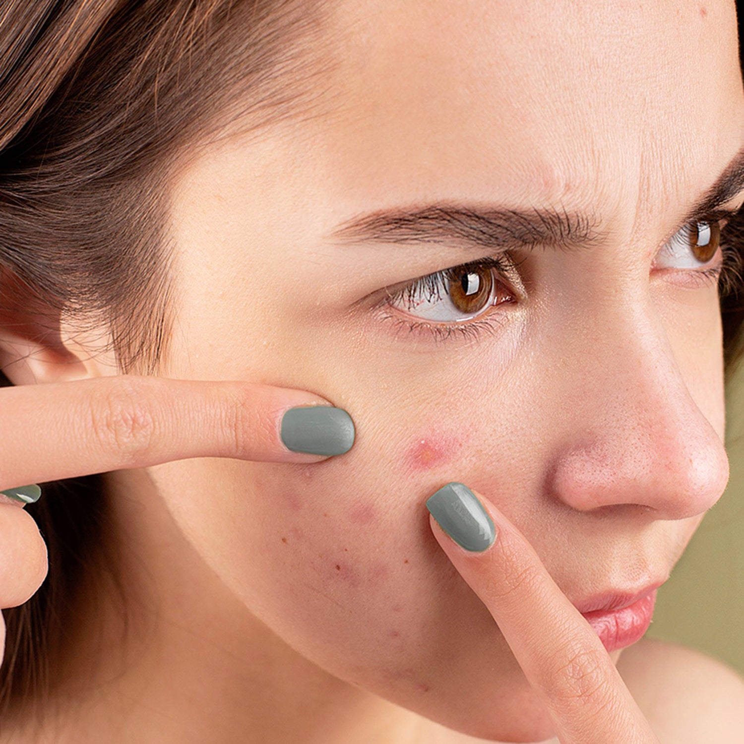 Granos en la cara: una guía sencilla e inspiradora – Serradas Sabão ...